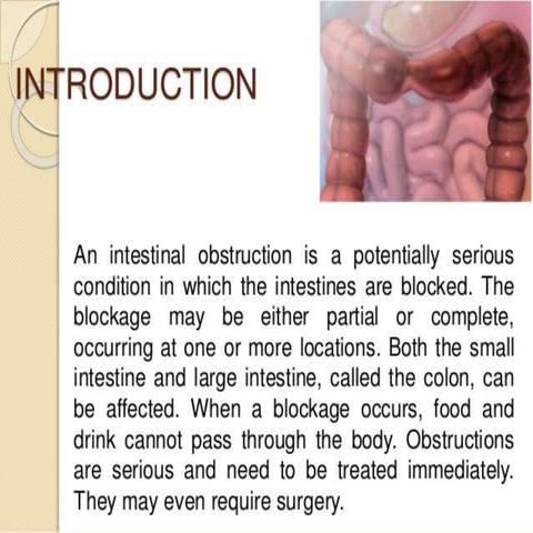 intestinal obstruction. B.Sc Nursing 2 year digestive system | PPTX
