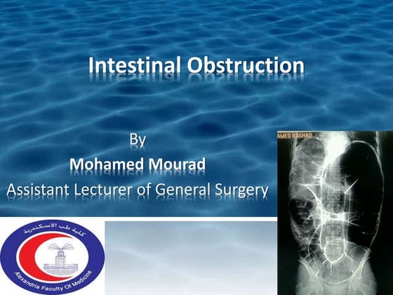 Surgical Management of Intestinal Obstruction | PPTX