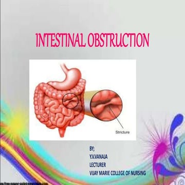 Intestinal obstruction | PPT