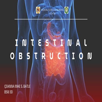 INTESTINAL OBSTRUCTION.pdf. health companion | PDF