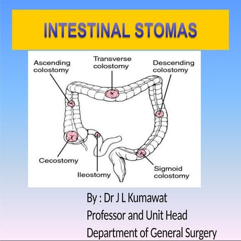Intestinal Stomas general surgery srb.pptx