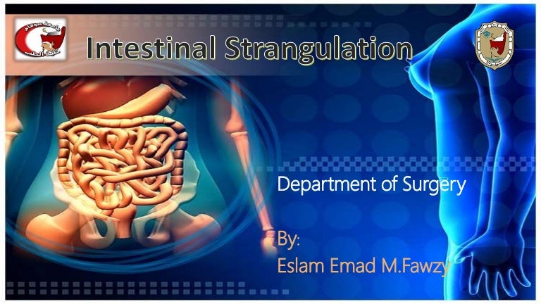 Intestinal ( Bowel) strangulation