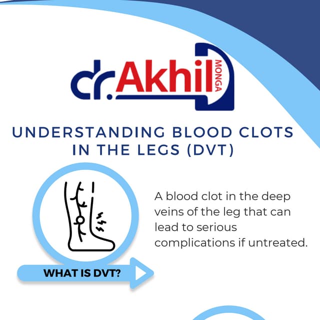 Understanding Blood Clots in the Legs (DVT) | PDF