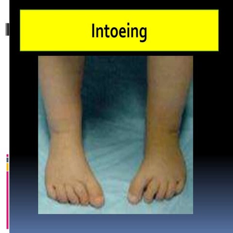 Intoeing | PPT