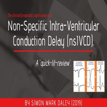Non-Specific Intra-Ventricular Conduction Delay - A quick-lit-review | PDF
