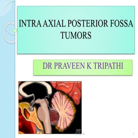 INTRA CRANIAL HEMORRHAGE- AGING BLOOD ON MRI | PPTX