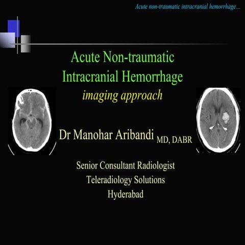 Intracranial hemorrhage dr.manohar | PPTX
