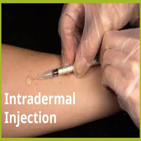 Intradermal-Route-of-Medication-A-Comprehensive-Overview.pptx