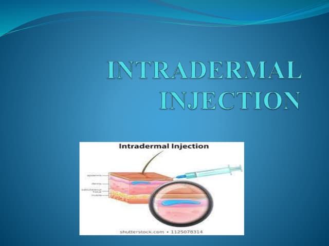 Intradermal injection- Introduction, procedure,complications | PPTX