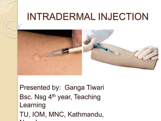 cannulation and introduction, sizes and site of cannula | PPT