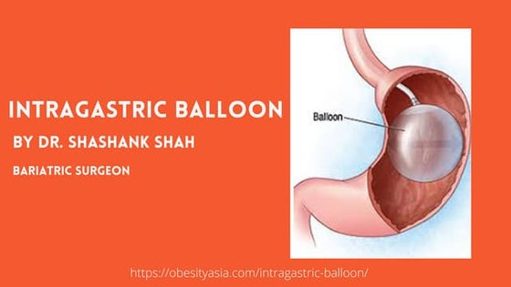 Gastric Balloon - Non Surgical Weight Loss Option.pptx