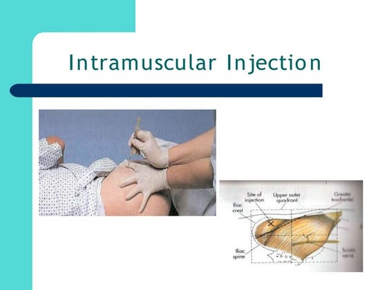 Intramuscular Injection(IM) injection | PPTX