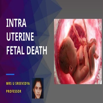 INTRA UTERINE DEATH.pptx INTRA UTERINE FETAL DEATH | PPTX