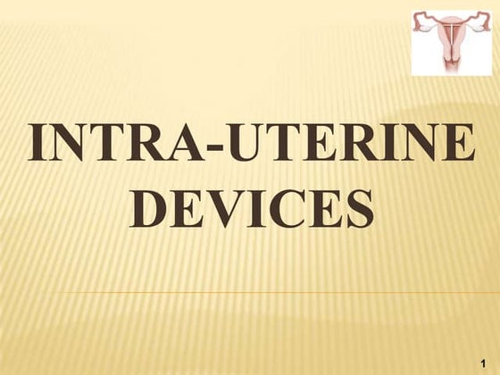 Intrauterine device (IUD) | PPTX