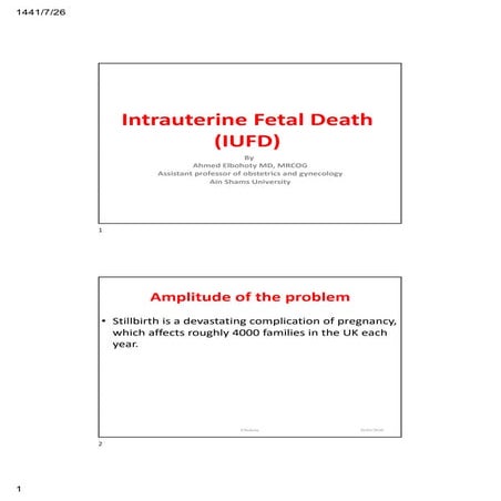 Intrauterine fetal death | PPTX