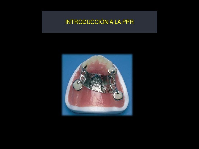 Introducción a la PPR