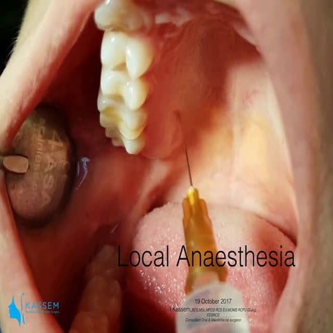 Introduction to local anaesthesia | PPT