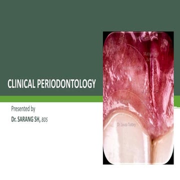 Anatomy of the Periodontium | PPT