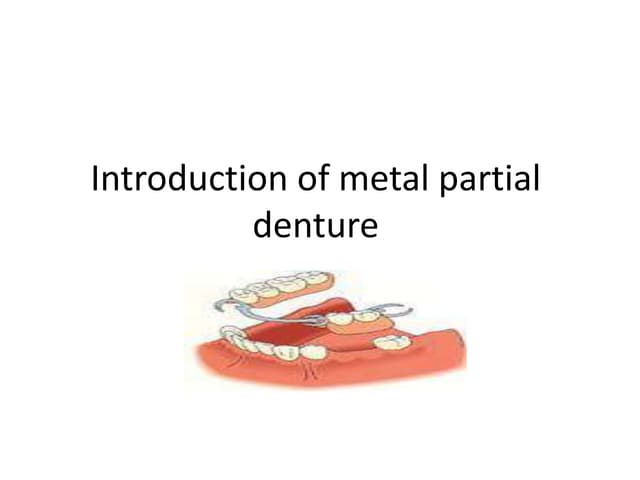 Introduction to fixed partial denture | PPT