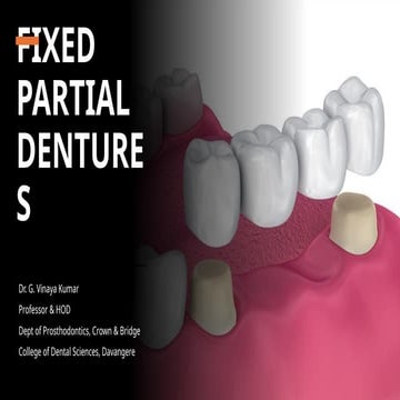Parts of fixed partial denture | PPTX