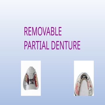 Removable partial denture | PPT