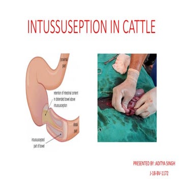 INTUSSUSCEPTION.pdf