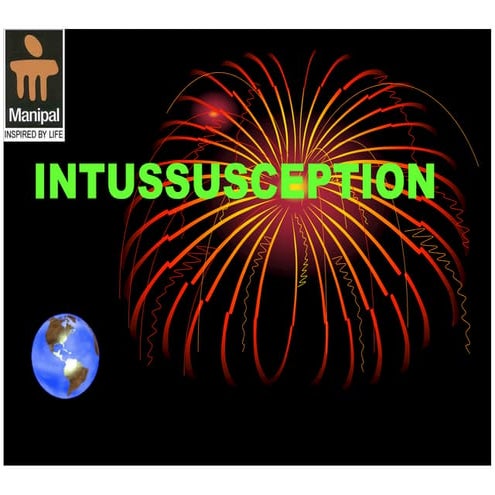 Pediatric Intussusception - An Overview | PDF