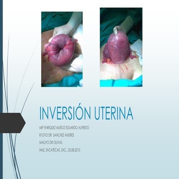 Hidrop Fetal Nieves Fernandez | PPT