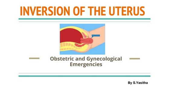 Inversion of the Uterus Approches to managemet.ppt