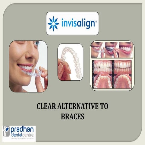 Invisalign | PPTX