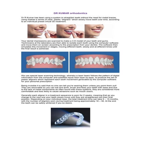 Invisalign orthodontics | PDF