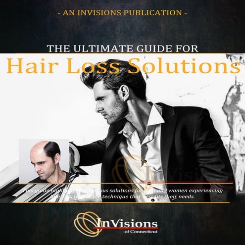 The Ultimate Guide for Hair Loss Solutions | PPT