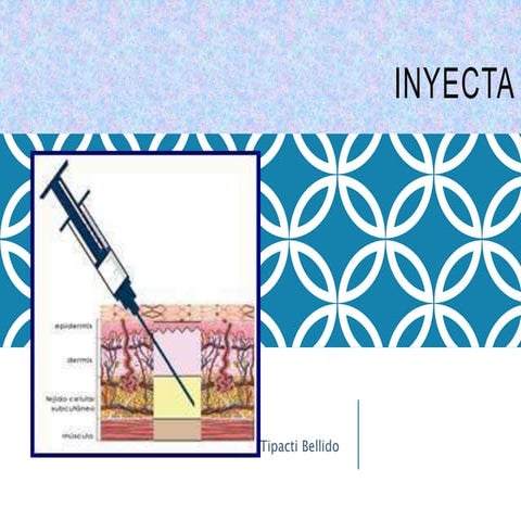 inyectaaaaa.pptx