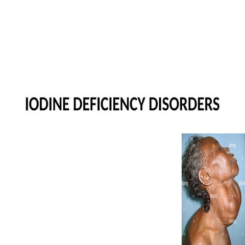 IODINE DEFICIENCY DISORDERS DETAILS OF NUTRITION CHAPTER | PPT