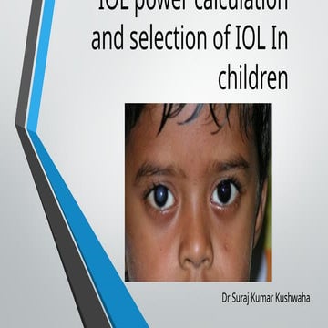 Intraoccular lens power selection-2.pptx