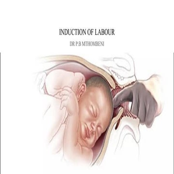 IOL tut. Induction of labour presentation | PDF