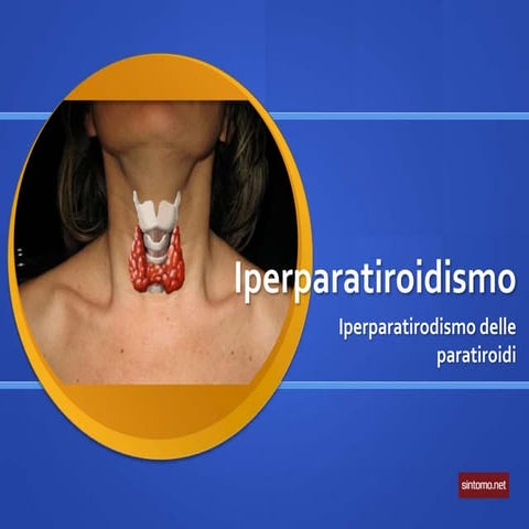 Iperparatiroidismo delle paratiroidi | PPTX