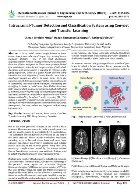 BRAIN TUMOR DETECTION ppts for seminar.pdf
