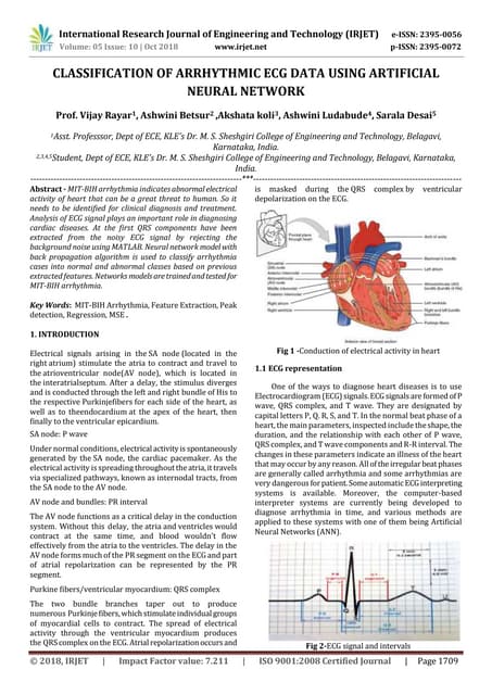 Irjet Classification Of Arrhythmic Ecg Data Using Artificial Neural 3201