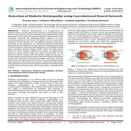 Automatic Detection of Diabetic Maculopathy from Fundus Images Using