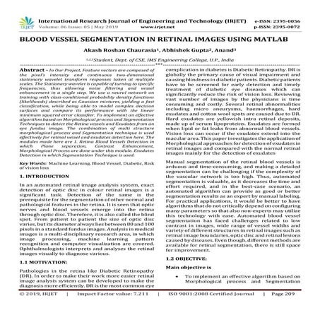 IRJET- Blood Vessel Segmentation in Retinal Images using Matlab | PDF