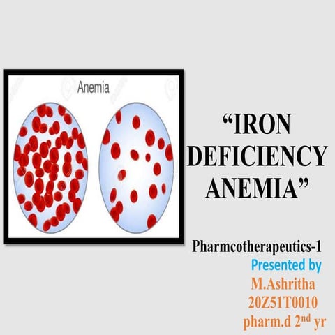 'iron anemia.ppt exam case.pptx