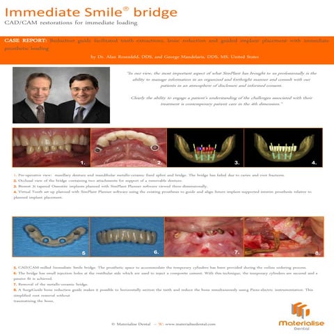 Immediate Smile Bridge: CAD/CAM Restoration Case with Dr. Rosenfeld and Dr. Mandelaris DDS, MS | PDF