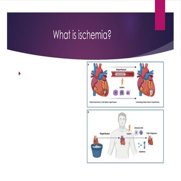 Ischemia. 2.ppt its about ischemia and how it dangerous | PPT