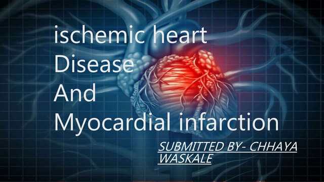 Myocardial infarction | PPTX