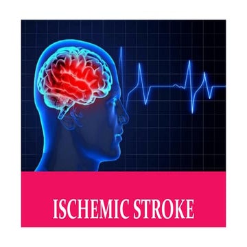 Ischemic stroke -Basics | PDF