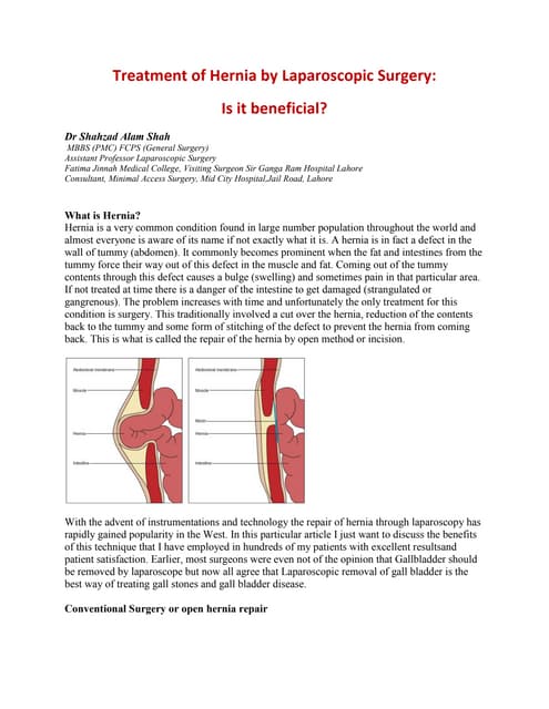 Which is Better for Hernia Open vs Laparoscopic Surgery | PPT