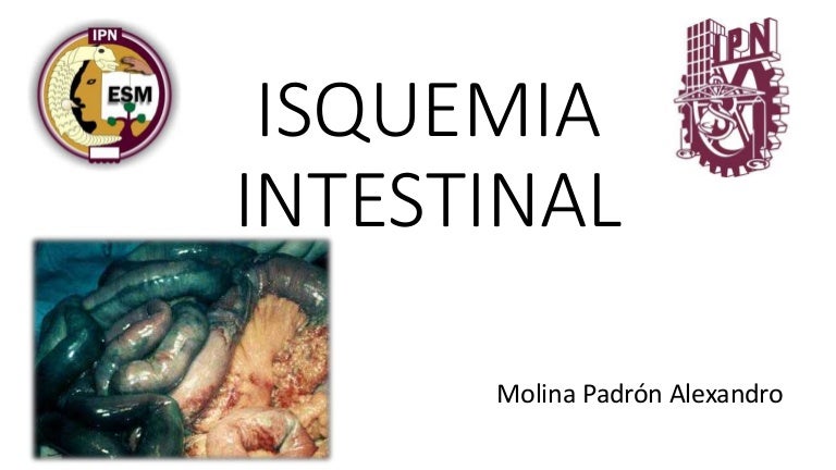 Isquemia intestinal