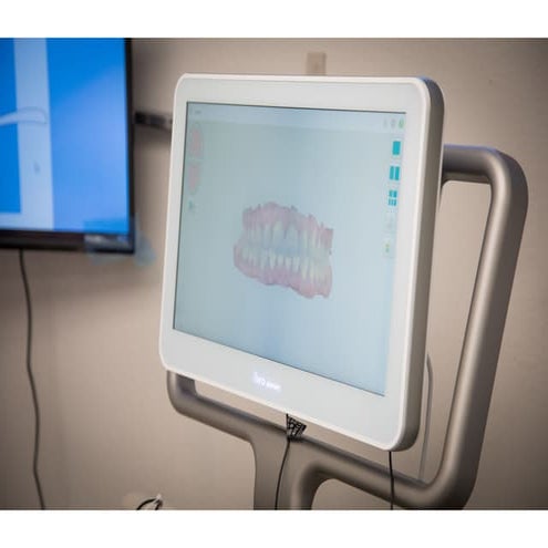 iTero Intraoral Scanners for Restorative and Orthodontic scanner being ...