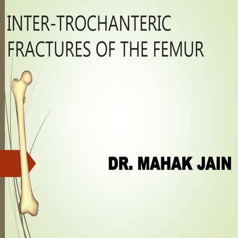 IT fractures.pptx